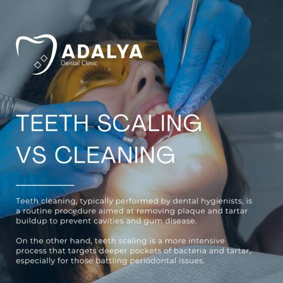 Teeth Scaling vs Cleaning: Key Differences, Cost, Benefits