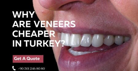 Turkey Teeth Packages: Affordable Dental Holiday Packages 2026