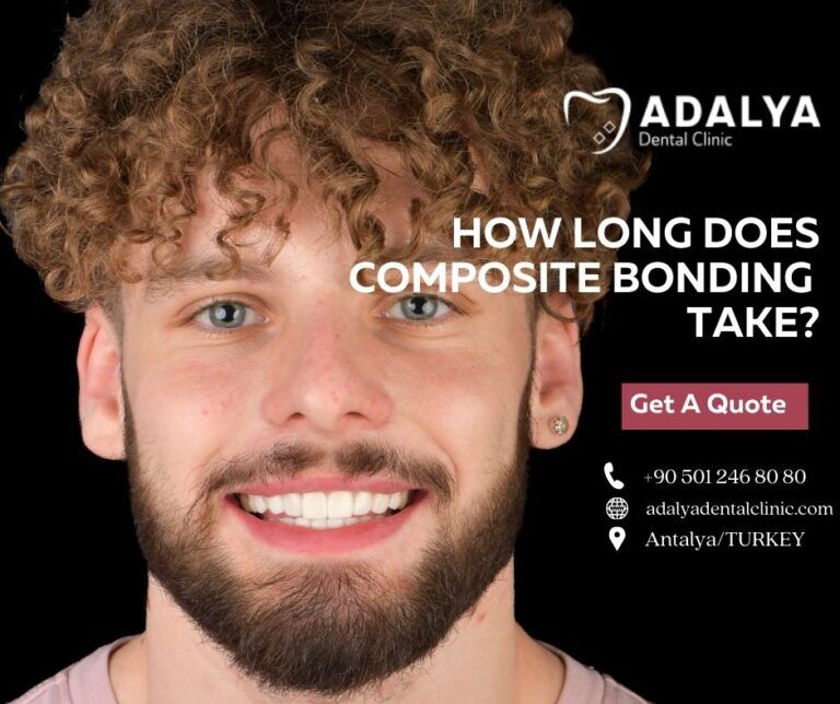 How Long Does Composite Bonding Take? | Adalya Dental Clinic