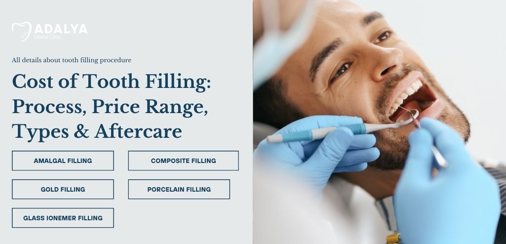 Cost of Tooth Filling Price Without Insurance Types Process