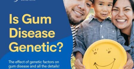 Receding Gum Stages - Early Receding Gums Stages | Adalya