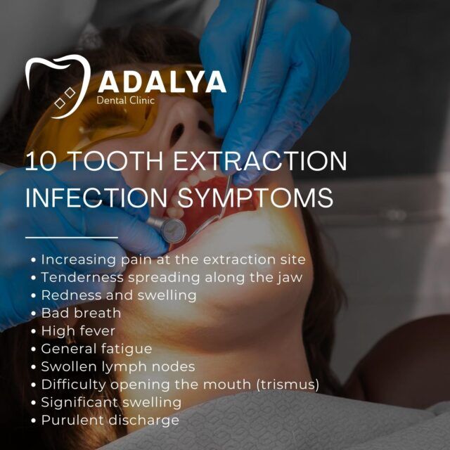 Tooth Extraction Infection Symptoms - Adalya Dental Clinic