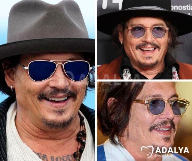 Johnny Depp Teeth: New, Rotting, Before & After Teeth Journey