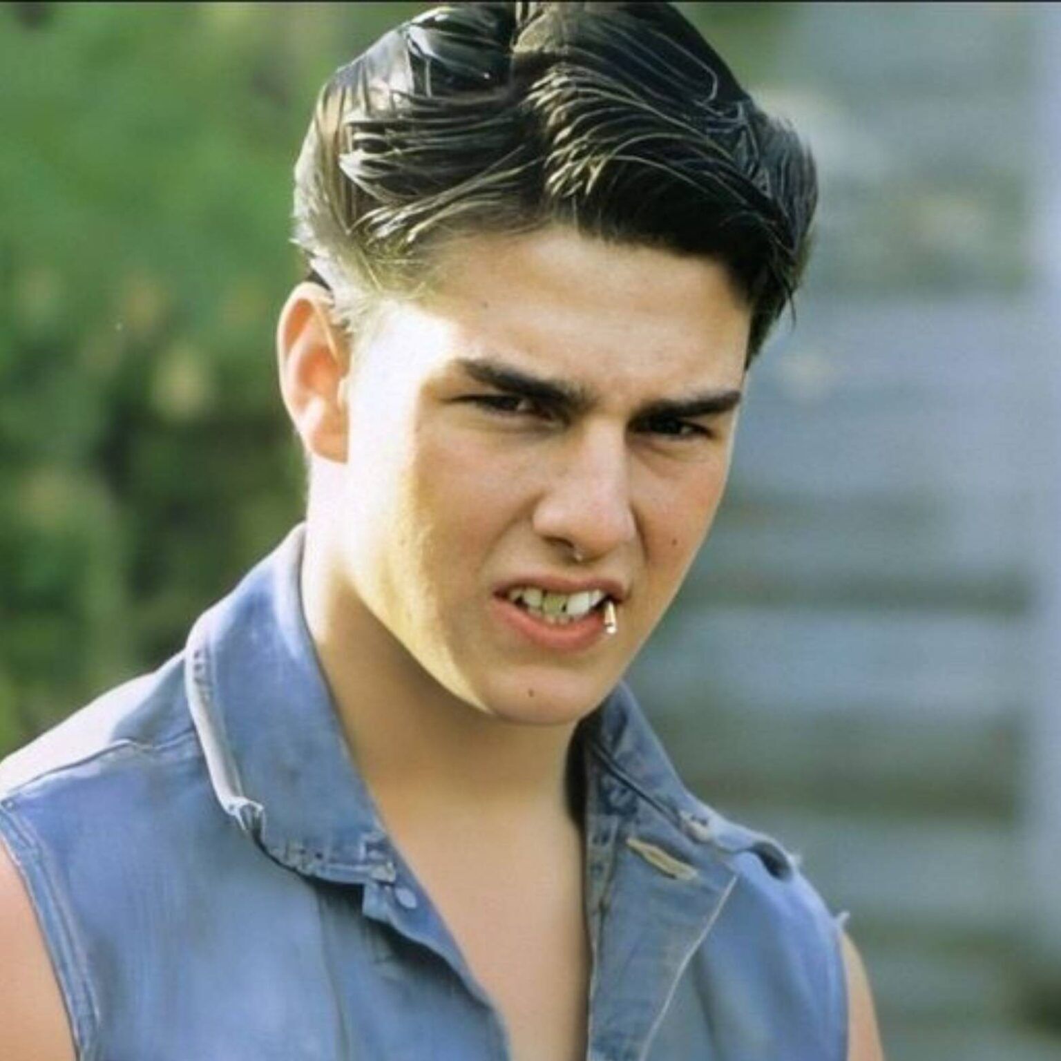 Tom Cruise Teeth: Before and After Journey, Teeth Line Problem