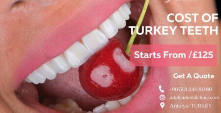 Turkey Teeth Packages: Affordable Dental Holiday Packages 2026