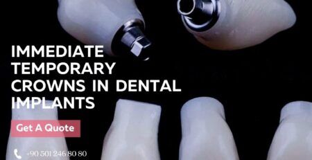 Bone Density For Dental Implants: D1, D2, D3, D4 Bone Qualities
